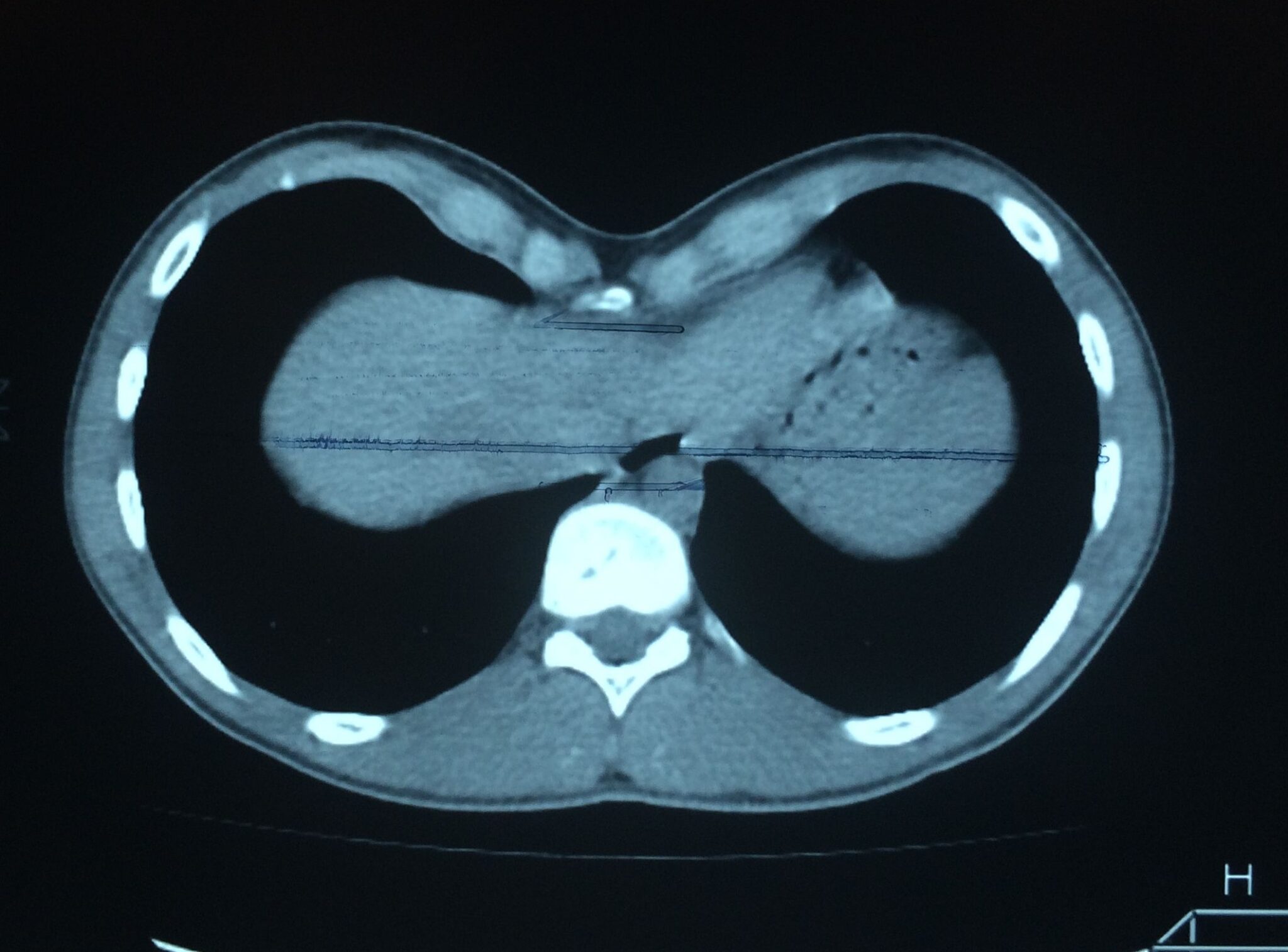 Estudios complementarios – Clinica Mi Pectus